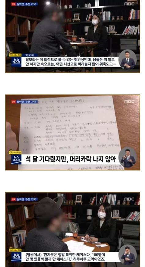 멀쩡한 4천모 날라간 탈모인 지금국내엔 네모판