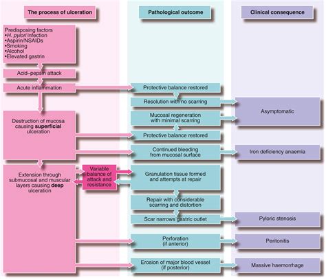 Peptic Ulceration And Related Disorders Clinical Tree