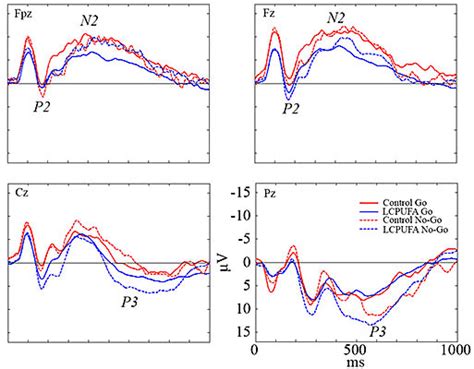 High Density EEG
