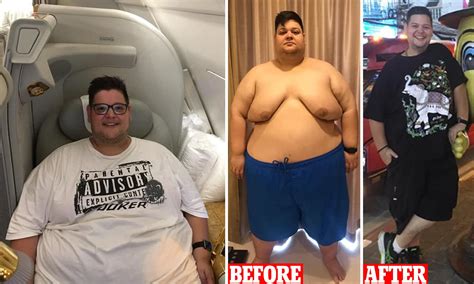 Super Morbidly Obese Before And After