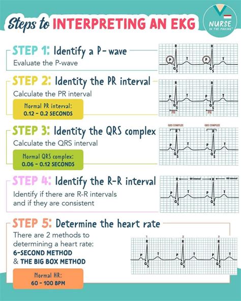 Kristine Tuttle On Instagram Step To Interpreting An Ekg Step 1 →