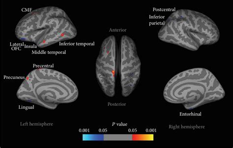 Figure 1 From Molecular And Functional Imaging Of Internet Addiction Semantic Scholar
