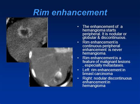 Detection And Characterization Ppt Video Online Download
