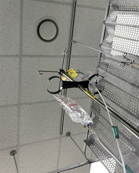 신장 요관 결석 증상 및 입원 수술 후기 1 네이버 블로그