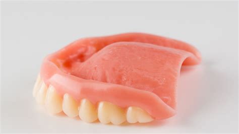 Prótese Dentária Flexível Saiba Tudo Sobre E Preço