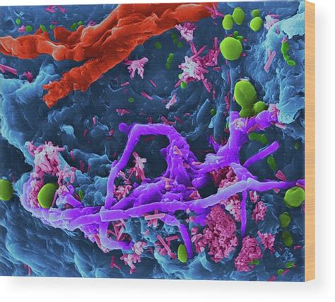 Kitchen Sponge Bacteria