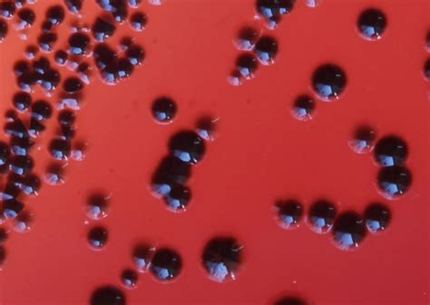 Vincularon El Mal De Alzheimer Con Una Bacteria Que Causa Una Enfermedad Dental Común Infobae