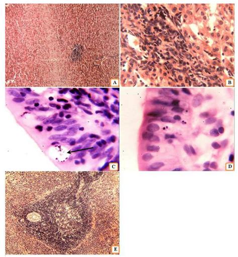 Tissue Sectionsfrommice With Spontaneous Microsporidiosis Hematoxylin