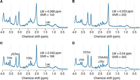 Representative Comparison Of Spectral Quality With And Without The