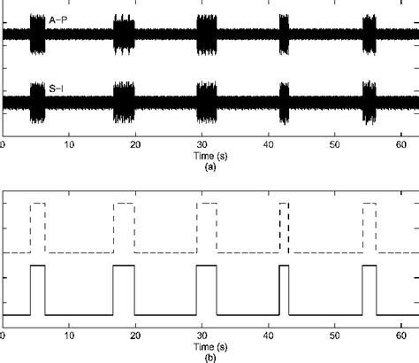 Figure 2 From Segmentation Of Dual Axis Swallowing Accelerometry