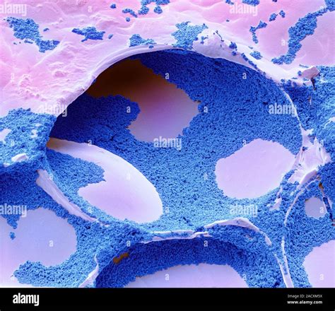 Electronic Ink Coloured Scanning Electron Micrograph Sem Of