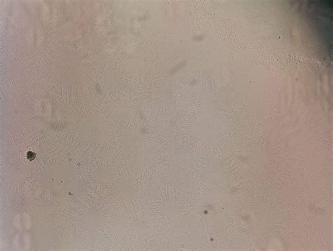 What Kind Of Infection Of Cel Lines Could It Be Researchgate