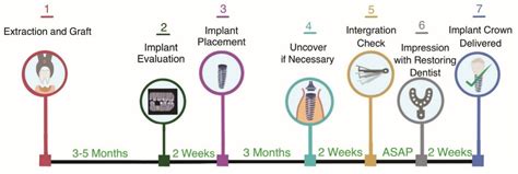 Timeline From Extraction To Dental Implant Peninsula