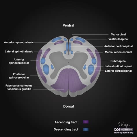 Lateral Corticospinal Tract Corticobulbar And Corticospinal Tracts Ii