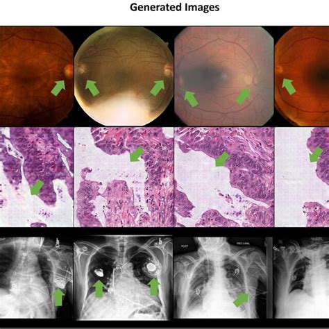 Gan Generated Images That Can Be Easily Identified As Synthetic