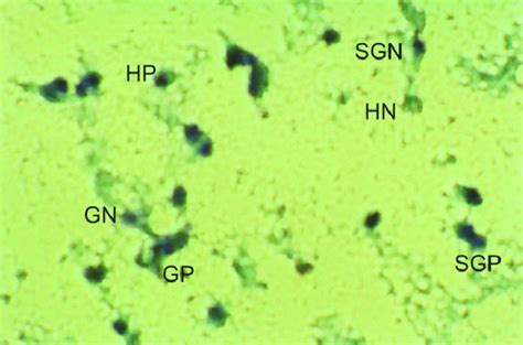 Light Micrographs Of Hemocyte Smear Preparation Of Macrobrachium Download Scientific Diagram