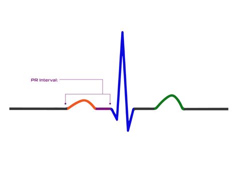 How To Read An Electrocardiogram Ekgecg Surefire Cpr