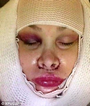 Transgender Star Cassandra Cass Spent 200000 To Look Like Jessica