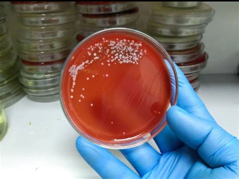 Medical Api Bacteria Bacteriology Pathogens Microbiology… Sarjo