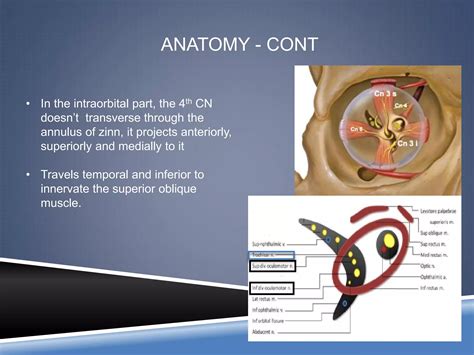 4th Nerve Palsy Pptx