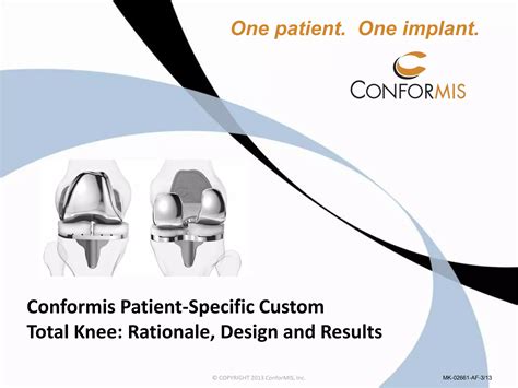 Conformis Patient Specific Custom Total Knee Replacement Pptx