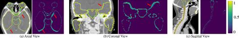 Figure 1 From Automatic Segmentation Of Organs At Risk From Head And