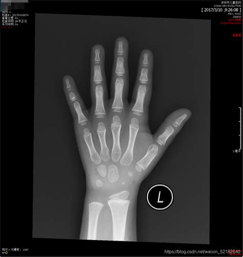Python Opencv 多边形拟合 Python Approxpolydp Csdn博客