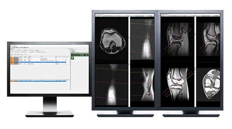 Imageview™ Dicom Viewers Candelis