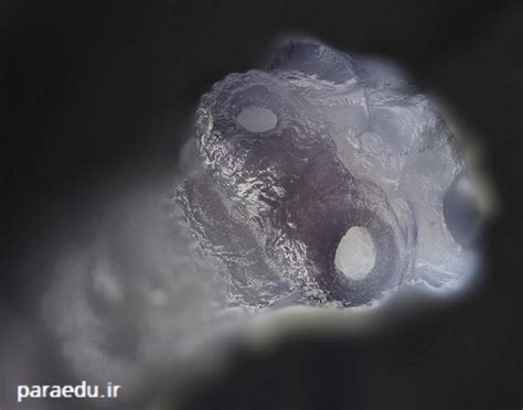 Taenia Saginata Escolex E Proglotes