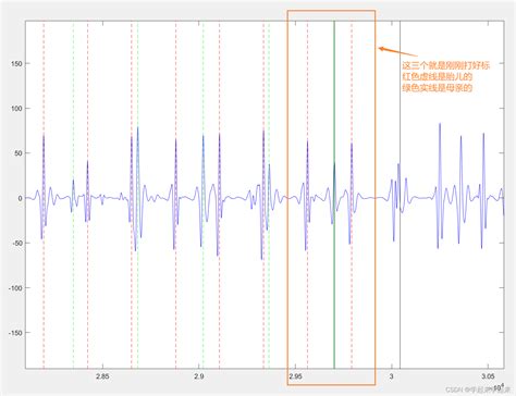 无接触母胎心电信号r峰打标代码（matlab）胎心监测峰值matlab Csdn博客