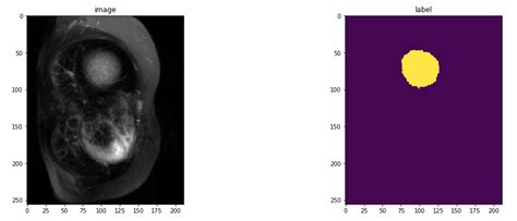 A Problem Of Supervoxel Generation · Issue 3 · Sha168adnet · Github