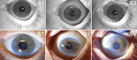 Post Mortem Human Iris Recognition Deepai