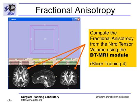 Ppt Converting Dti Data Into Nrrd File Format Powerpoint Presentation