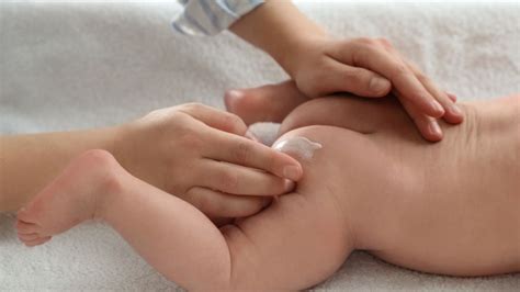 Cea Mai Buna Crema Pentru Eritem Fesier Recomandari Si Pareri MamiGhid