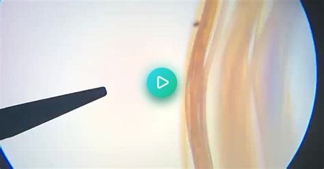 Polyester Through A Microscope Album On Imgur