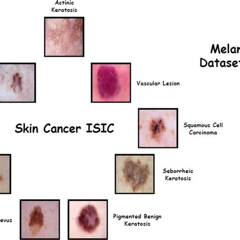 The Gradcam For Five Classes From The Skin Cancer Isic Dataset Using Download Scientific