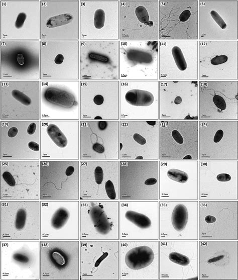 Transmission Electron Micrographs Of Cells Of The Strains Isolated In Download Scientific