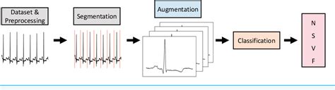 Figure 3 From Classification Of Imbalanced Ecgs Through Segmentation Models And Augmented By