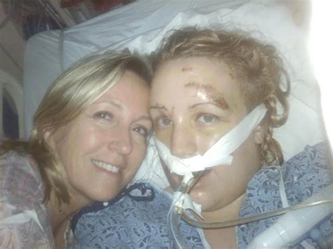 Melissa Dohmes Brutal Attack And Incredible Recovery