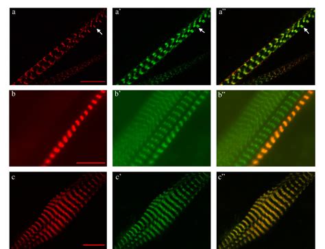 Figure 4 From Sarcomeric Alpha Actinin Defective In Vinculin Binding