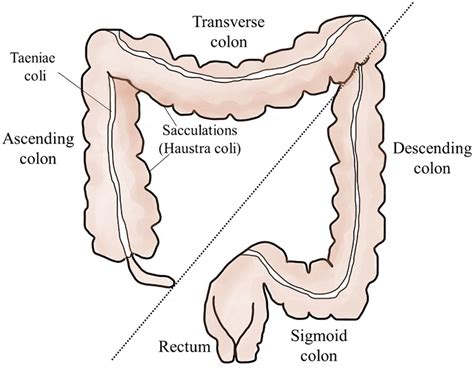 Classification And Histological Characteristics Of Colorectal Cancer