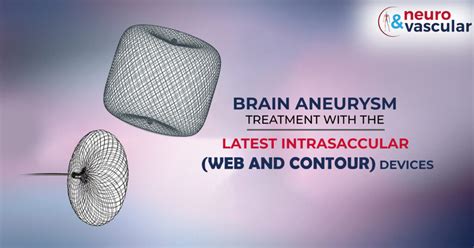 Brain Aneurysm Treatment With Intrasaccular Web And Contour Devices