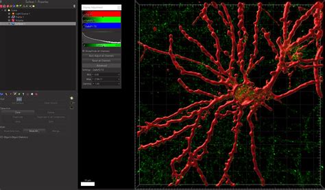 Using A Surface To Mask A Channel In Imaris Queensland Brain