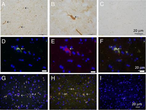 Colocalization Of α Syn With Oxi γ Syn In Amygdala And Substantia Nigra Download Scientific