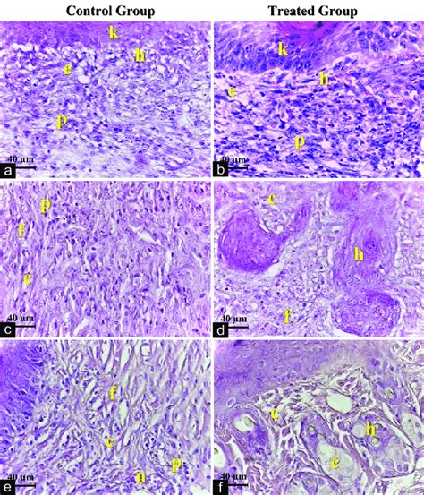 A Control Group 7 Days Large Numbers Of Polymorphonuclear Cells P Download Scientific