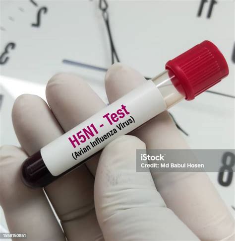 H5n1 조류 독감 또는 조류 독감에 대한 혈액 샘플 A형 인플루엔자 바이러스에 대한 스톡 사진 및 기타 이미지 Istock