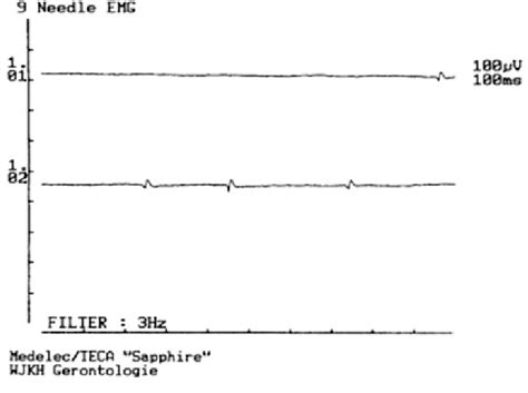 F T Female Age 75 Left Tib Ant Muscle Download Scientific Diagram