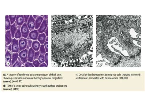 L1 Skin Science Of Epidermis Dermis And Subdemis Histology And Molecular Biology Of The Skin Ppt