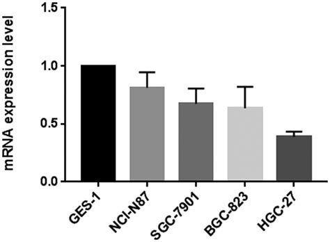 Effect Of Klf17 Overexpression On Epithelialmesenchymal Transition Of