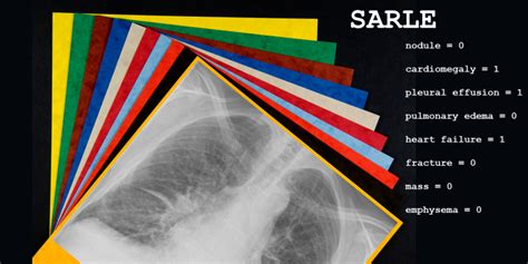 Machine Learning Glass Box